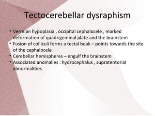 Congenital malformations of brain | PPT
