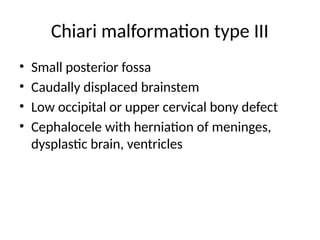 Congenital malformations of brain rjj.pptx