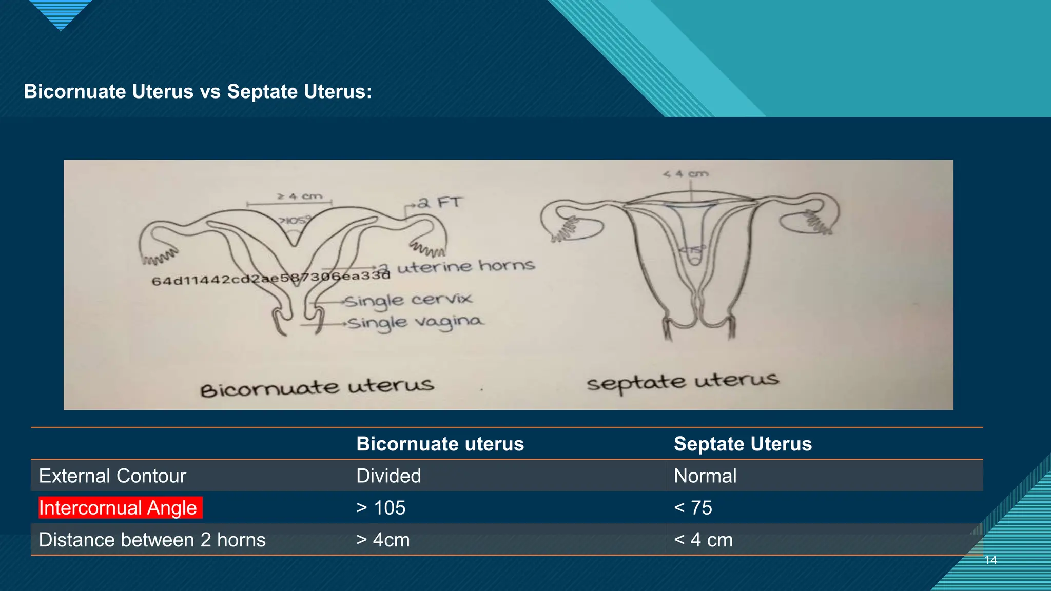 Congenital Malformations Of Female Genital - Priyanshu.pptx ...