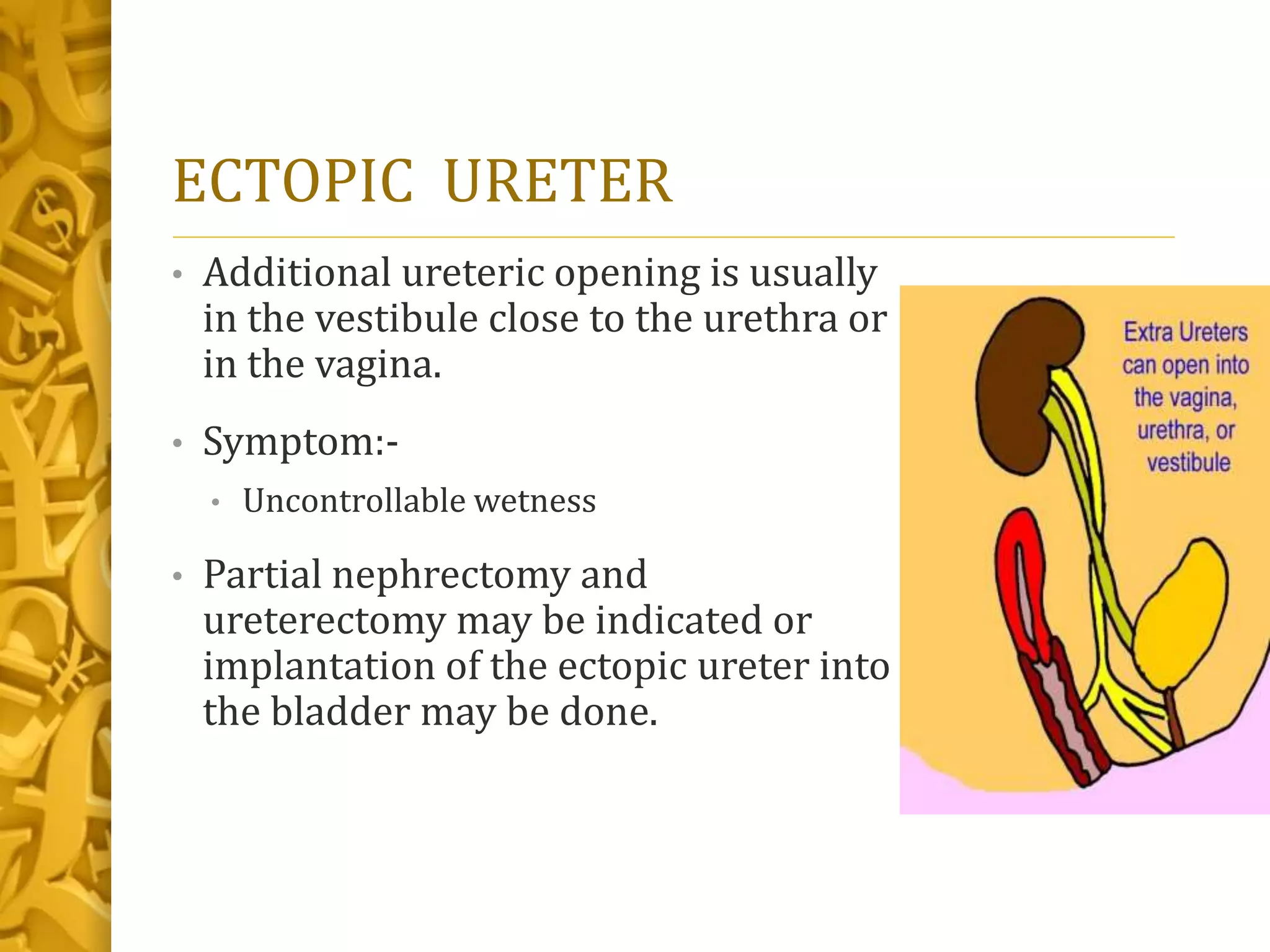 Congenital malformations of female genital tract | PPTX