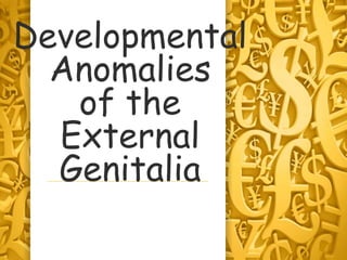 Congenital malformations of female genital tract | PPTX