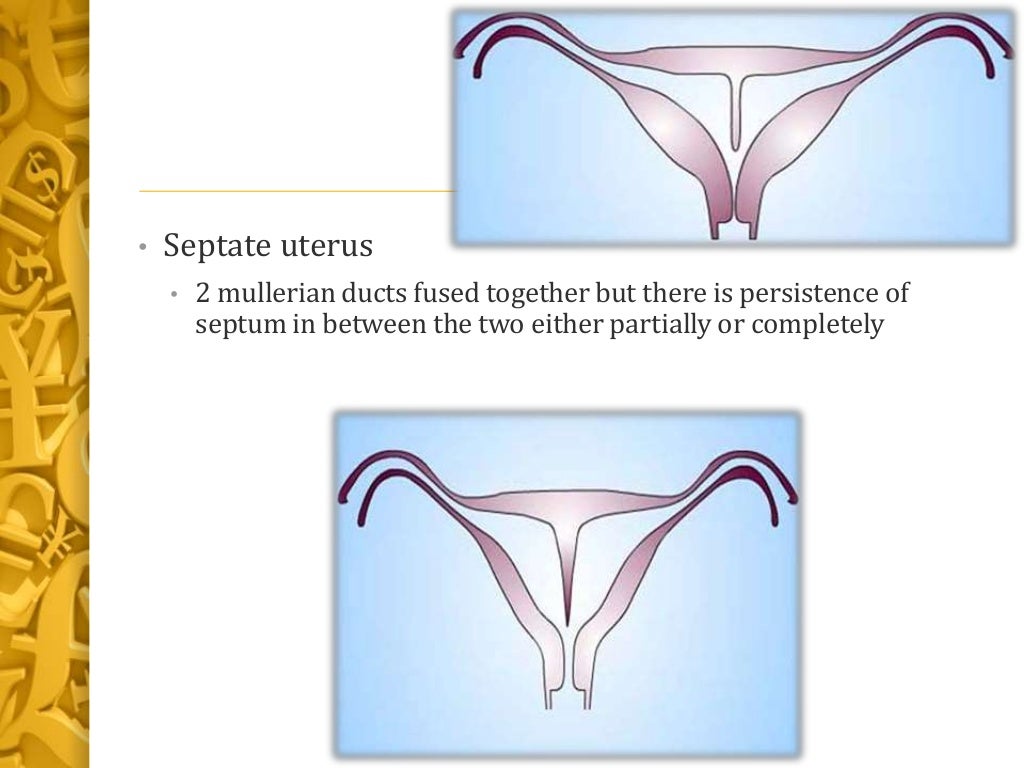 Congenital Malformations Of Female Genital Tract