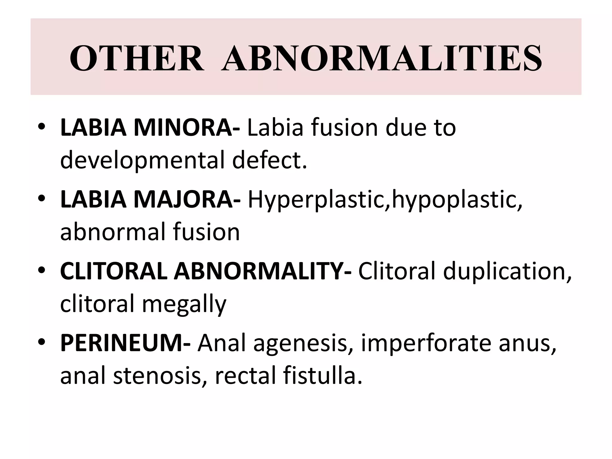 Congenital malformations of female genital tract ppt | PPTX