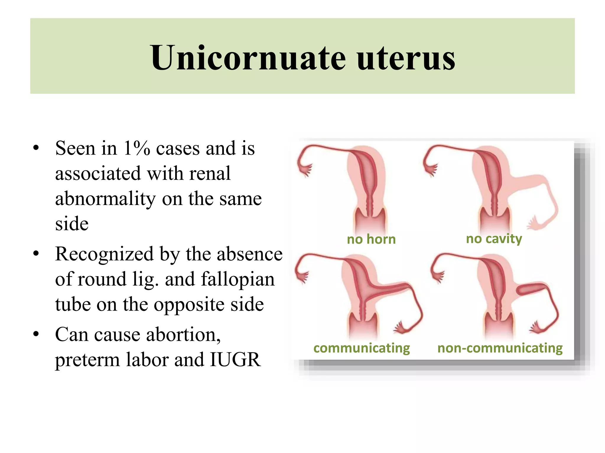 Congenital malformations of genital organs | PPTX
