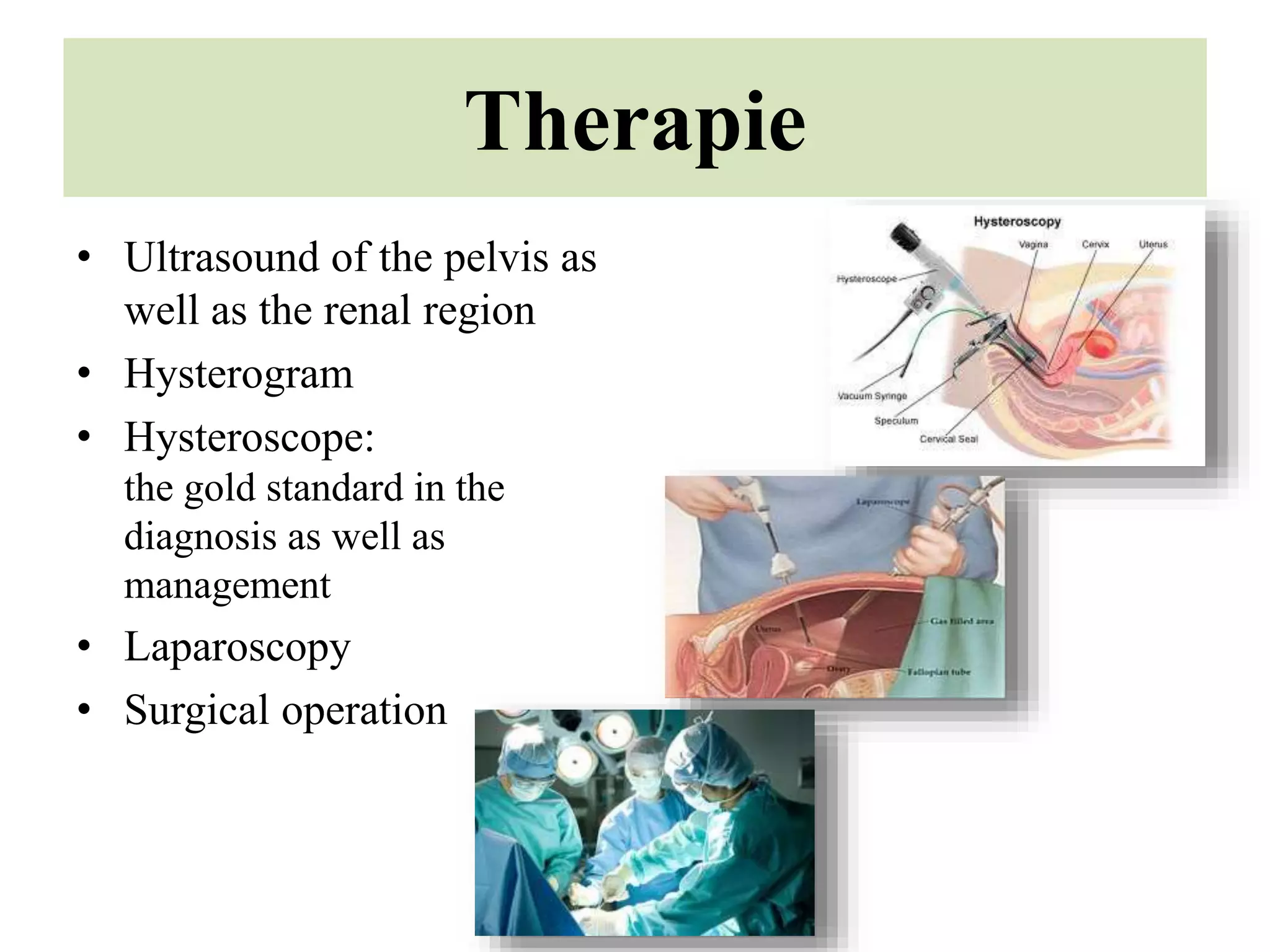 Congenital malformations of genital organs | PPTX