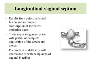Congenital malformations of genital organs | PPTX