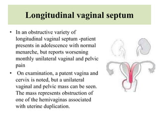 Longitudinal Vaginal Septum