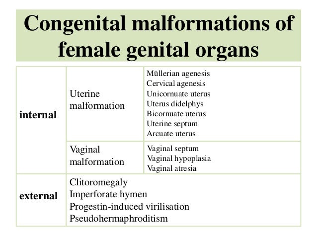 Congenital Malformations Of Genital Organs
