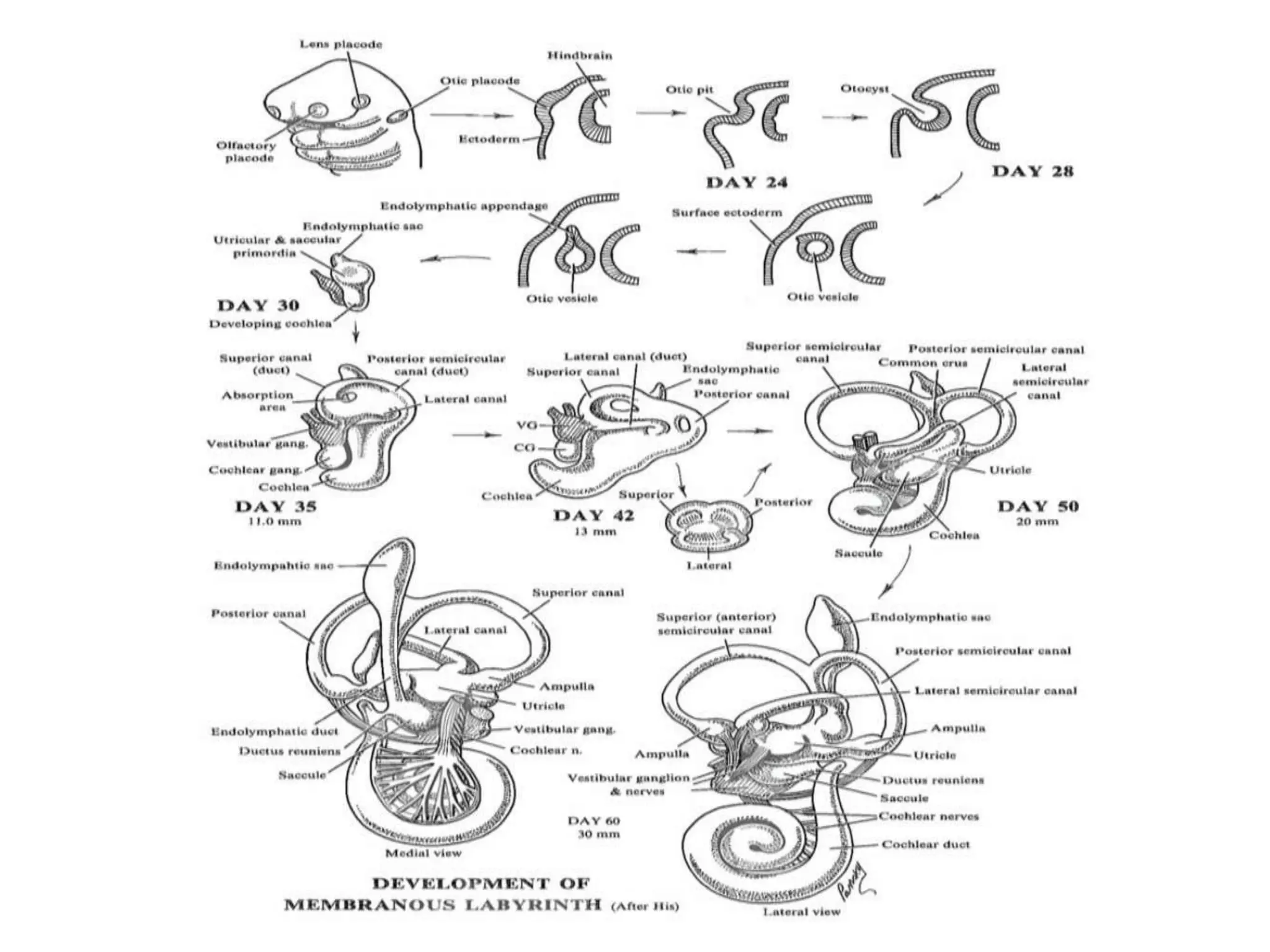 Congenital Malformations of Inner Ear.pptx