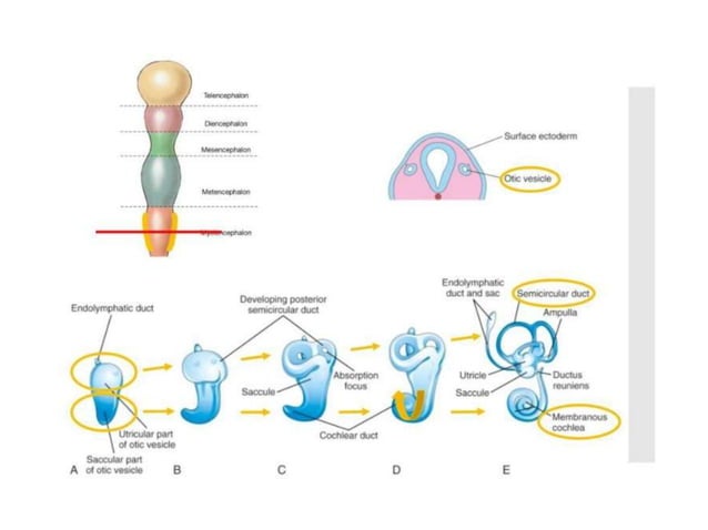 Congenital Malformations of Inner Ear.pptx | Ear, Nose and Throat ...