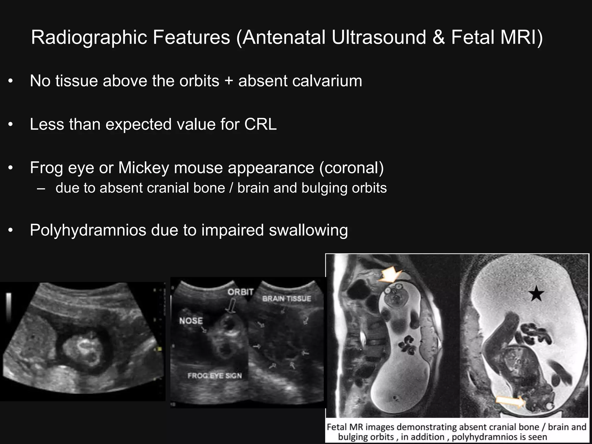 Congenital malformations of the brain abdul final | PDF