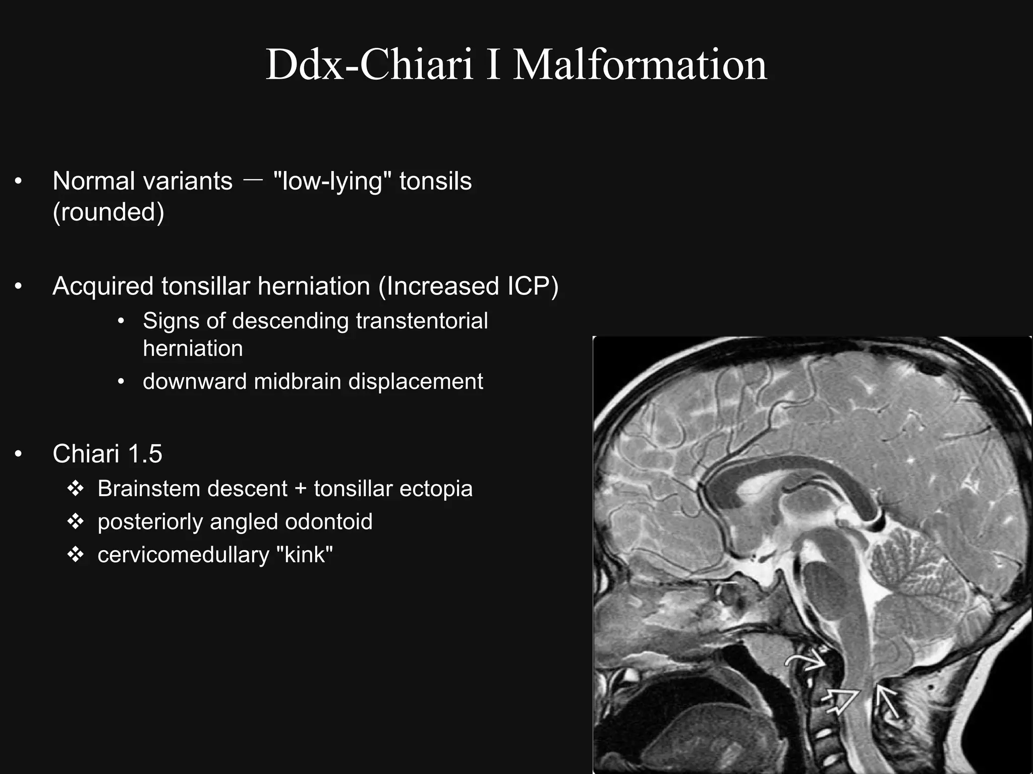 Congenital malformations of the brain abdul final | PDF