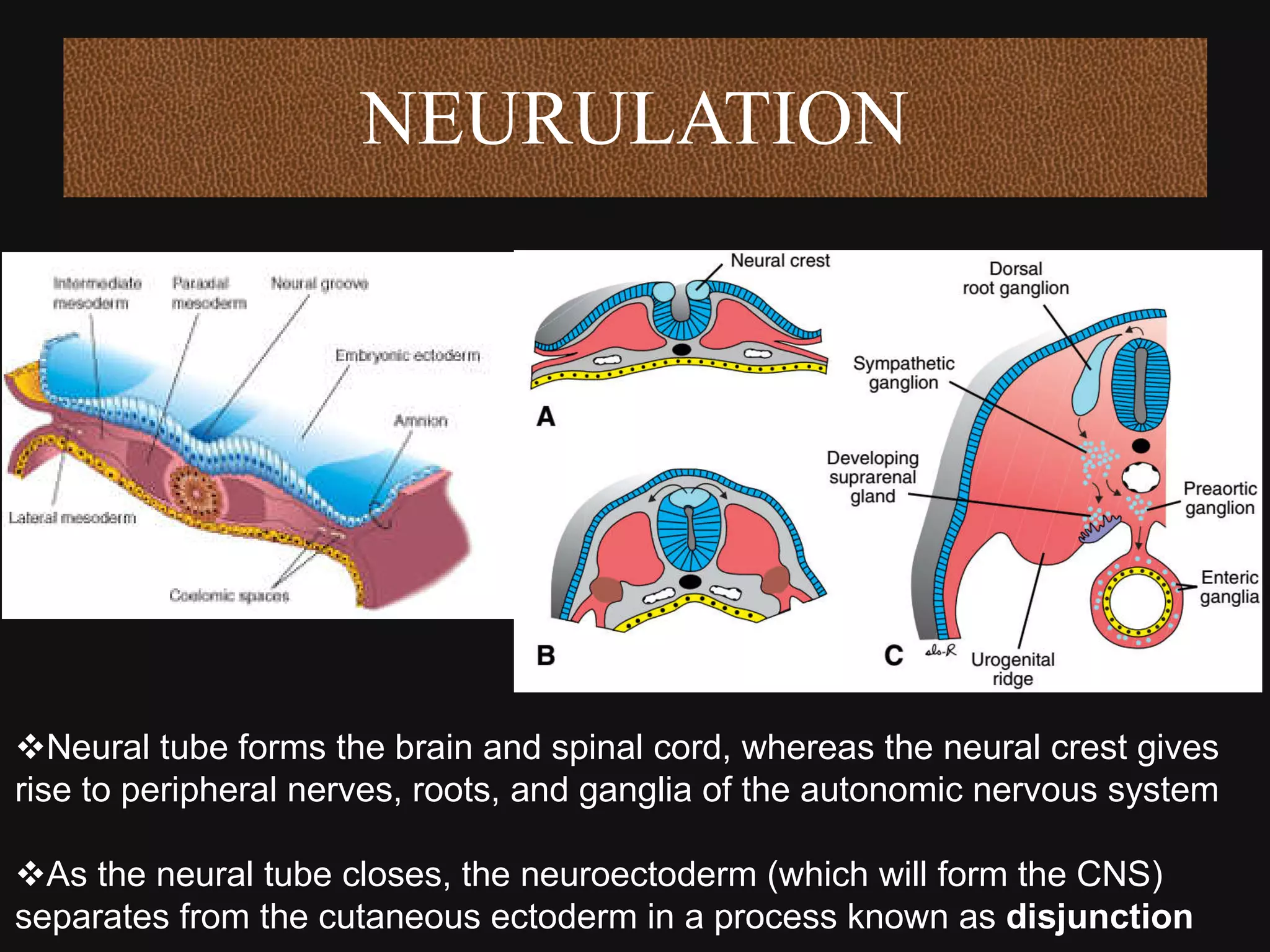 Congenital malformations of the brain abdul final | PDF