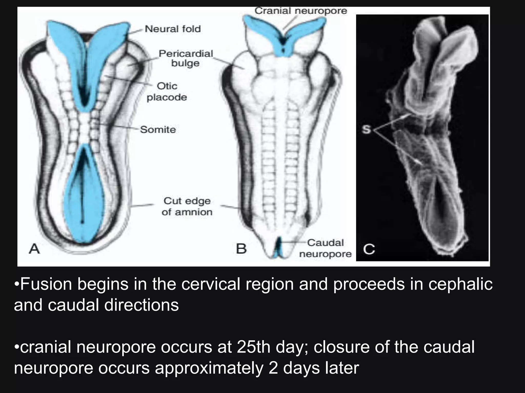 Congenital malformations of the brain abdul final | PDF
