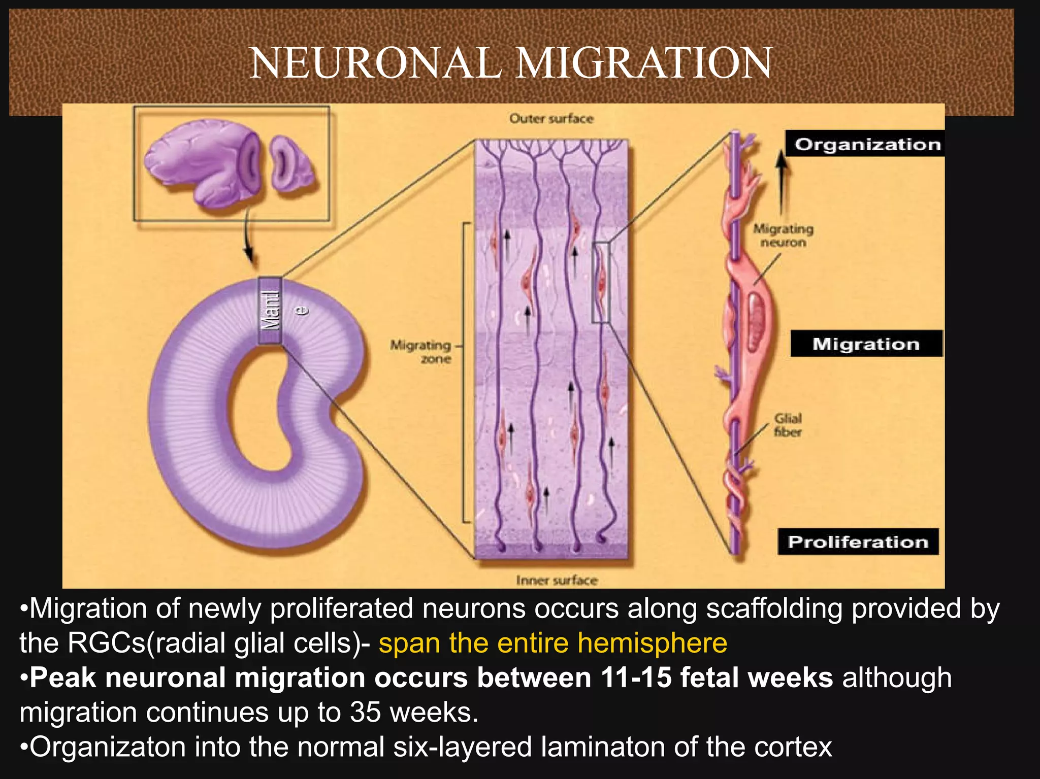 Congenital malformations of the brain abdul final | PDF