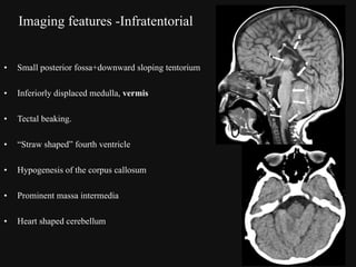 Congenital malformations of the brain abdul final | PDF