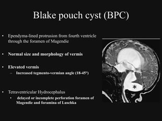 Congenital malformations of the brain abdul final | PDF