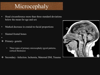 Congenital malformations of the brain abdul final | PDF