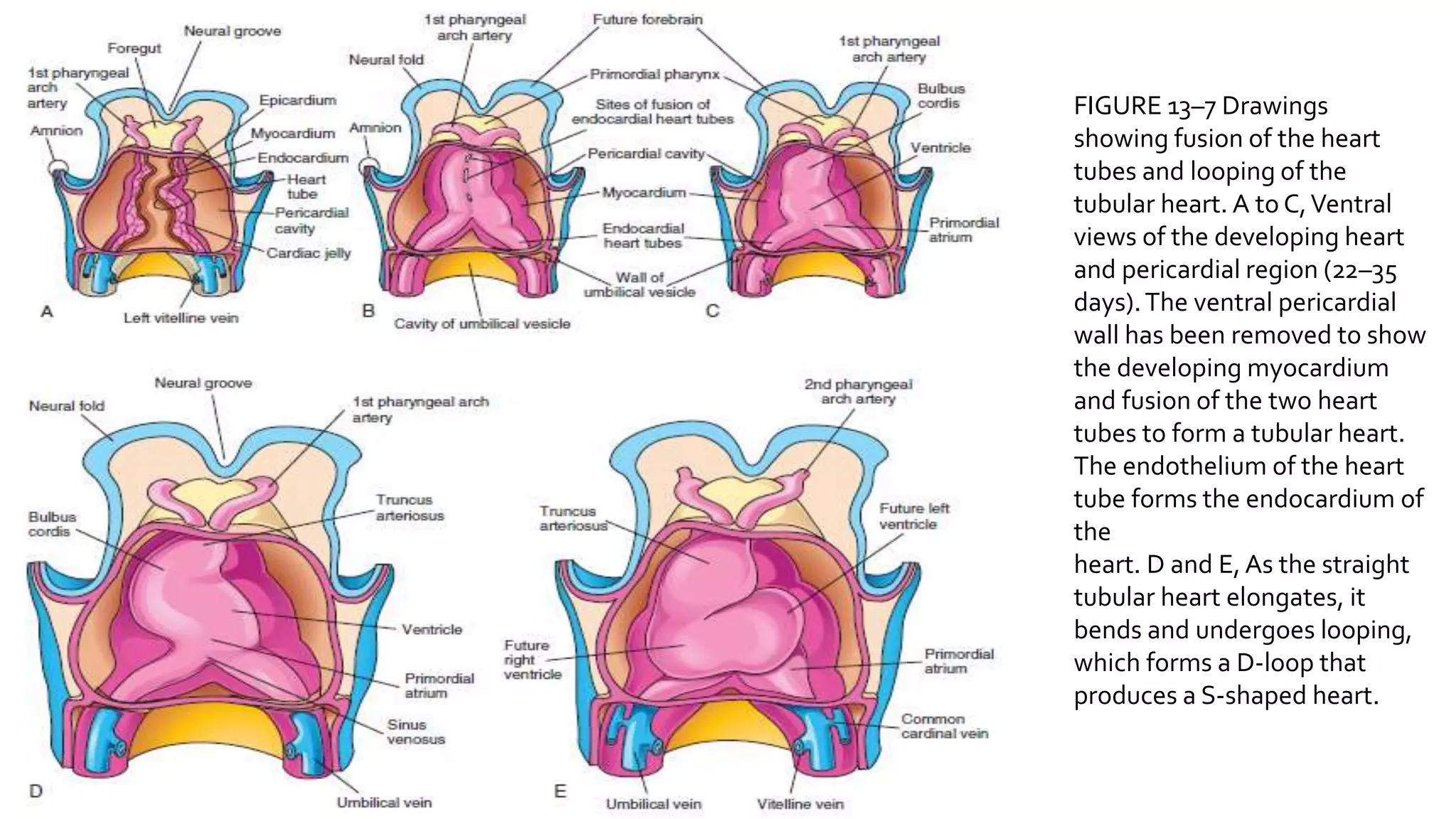 Congenital malformation the the heart | PPTX