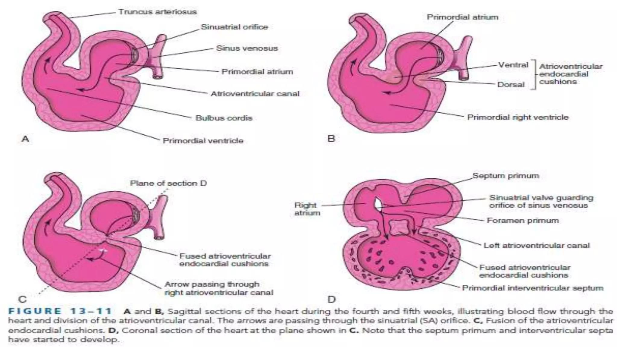 Congenital malformation the the heart | PPTX