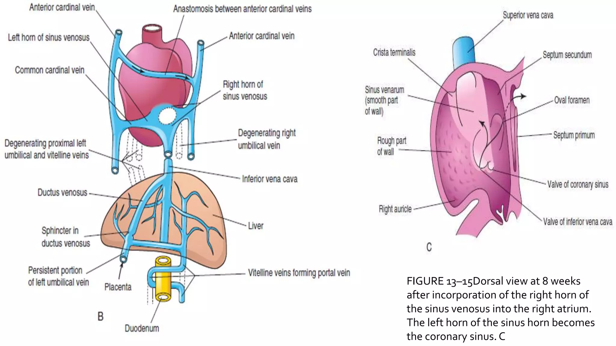 Congenital malformation the the heart | PPTX