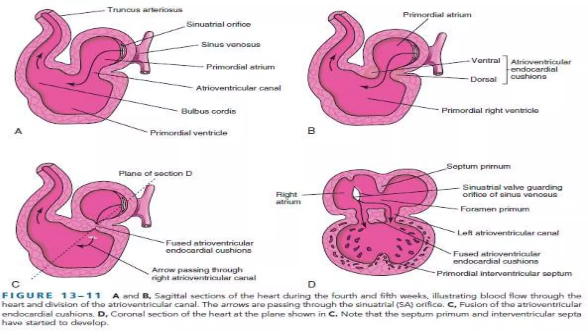 Congenital malformation the the heart | PPTX