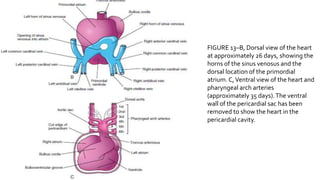 Congenital malformation the the heart | PPTX