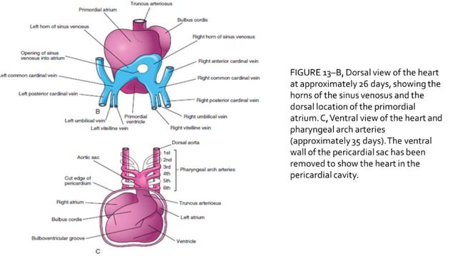 Congenital malformation the the heart | PPTX | Heart and Cardiovascular ...