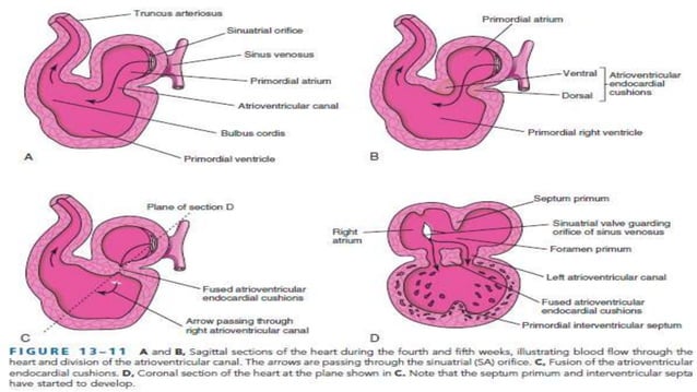 Congenital malformation the the heart | PPTX | Heart and Cardiovascular ...