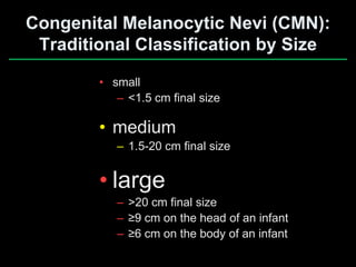 Congenital melanocytic nevi when to worry & when to treat
