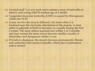 Congenital muscular torticolis | PPTX