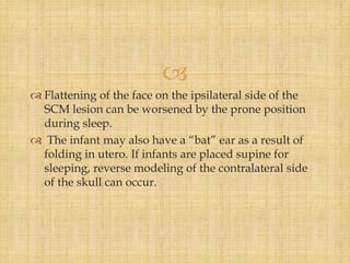 Congenital muscular torticolis | PPTX