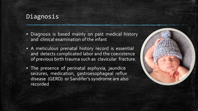 Congenital muscular torticollis | PPTX | Pregnancy | Reproductive Health
