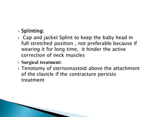 Congenital Muscular Torticollis.pd peedsf | PPT