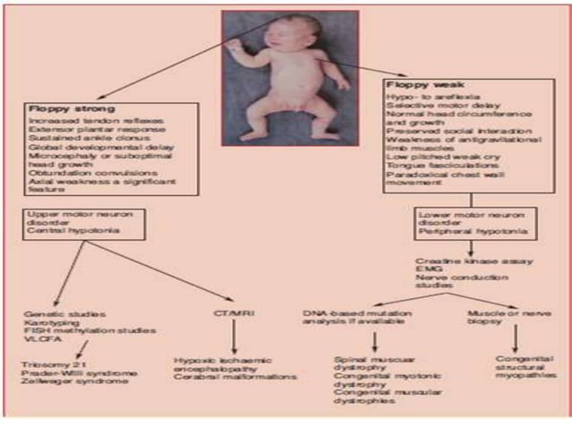 Congenital myopathy | PPTX | Physical Therapy | Wellness