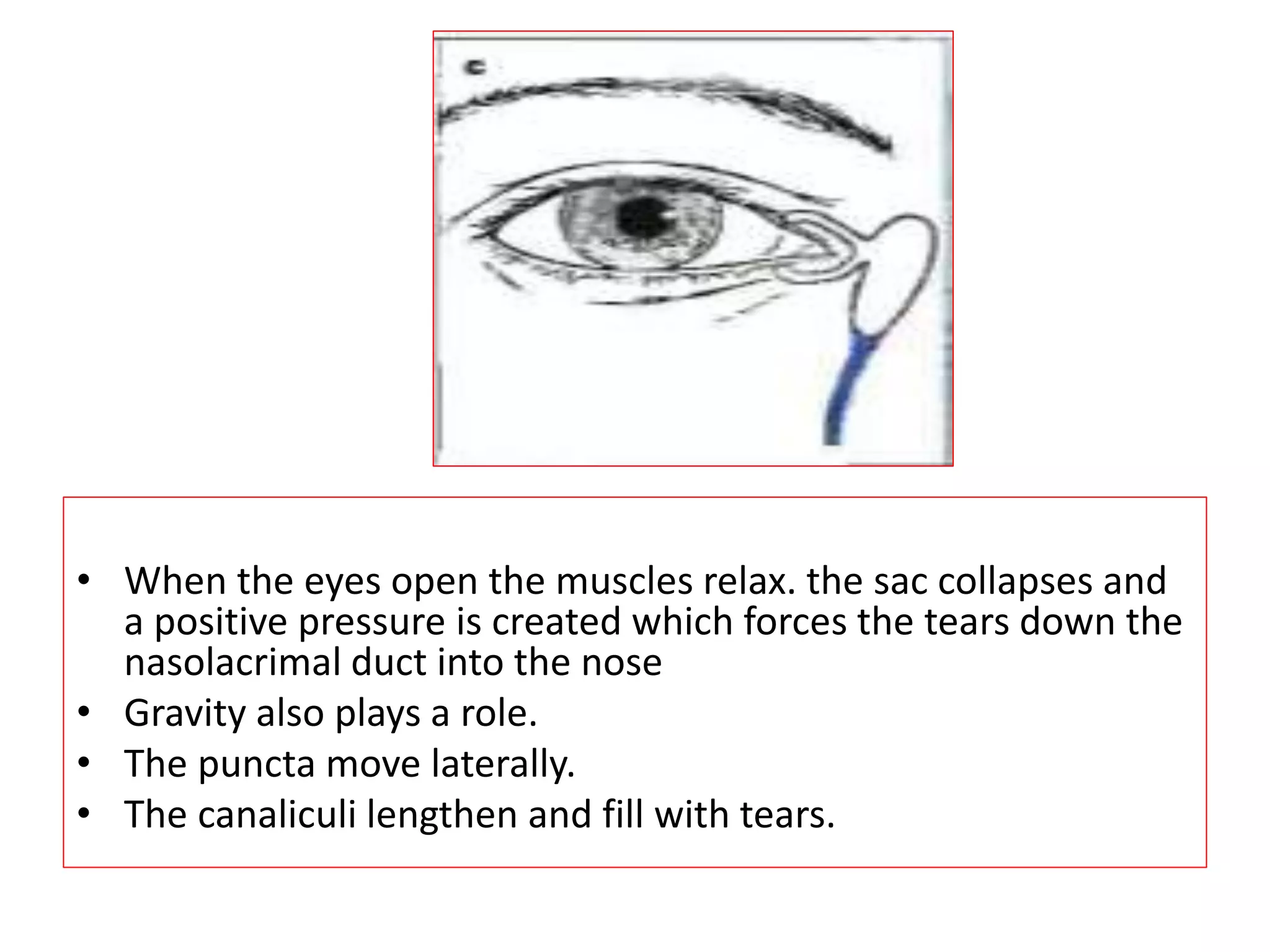 Congenital nasolacrimal duct obstruction | PPTX