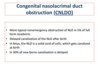 Congenital nasolacrimal duct obstruction | PPTX