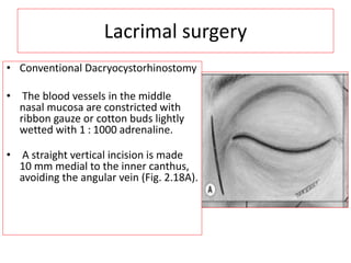 Congenital nasolacrimal duct obstruction | PPTX