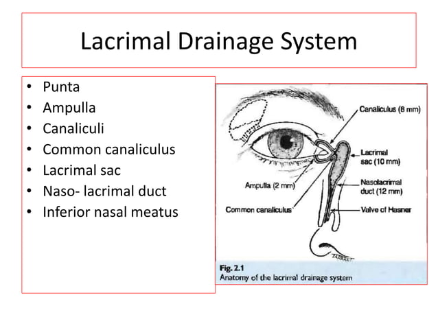 Congenital Nasolacrimal Duct Obstruction Ppt