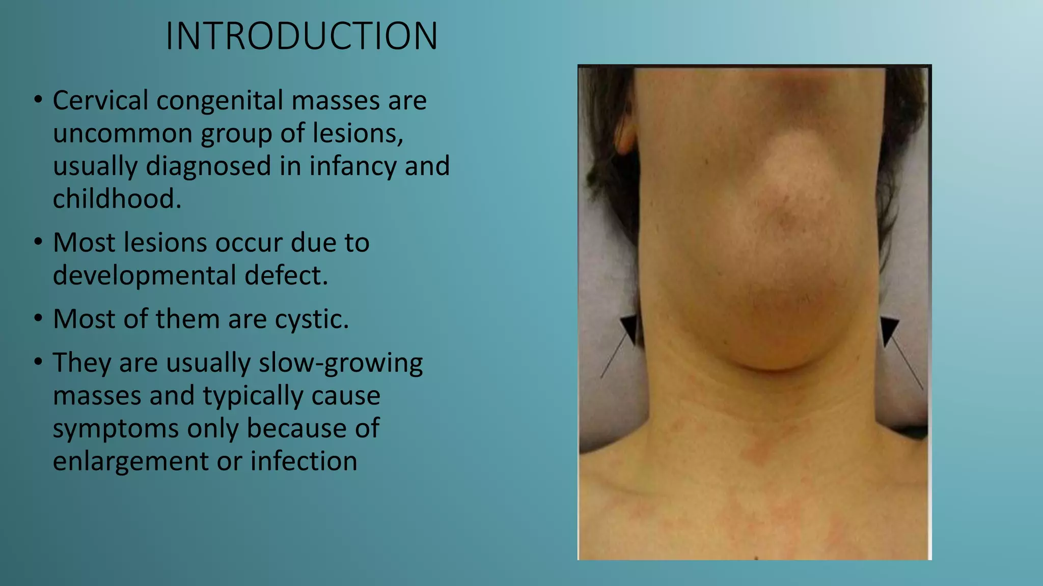 Congenital neck mass radiology pk final | PPTX