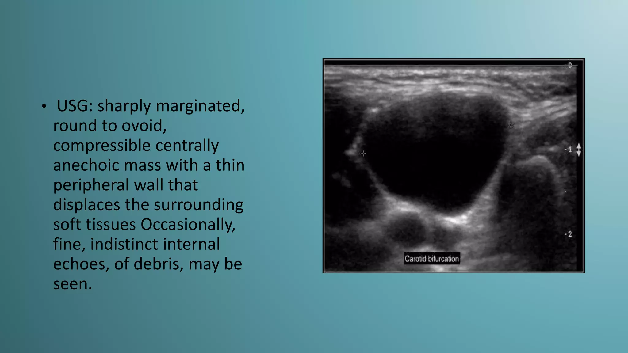 Congenital neck mass radiology pk final | PPTX