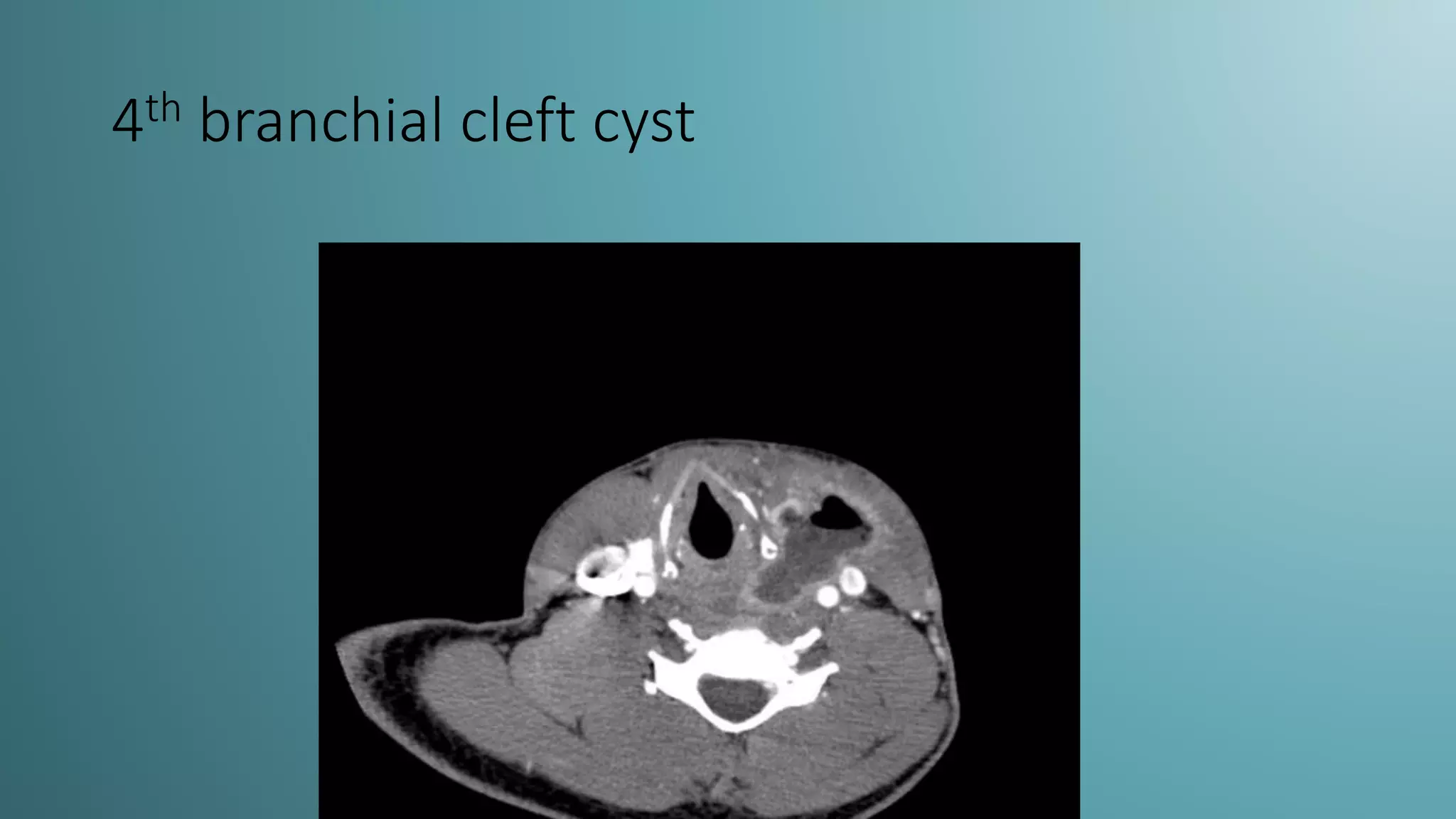 Congenital neck mass radiology pk final | PPTX