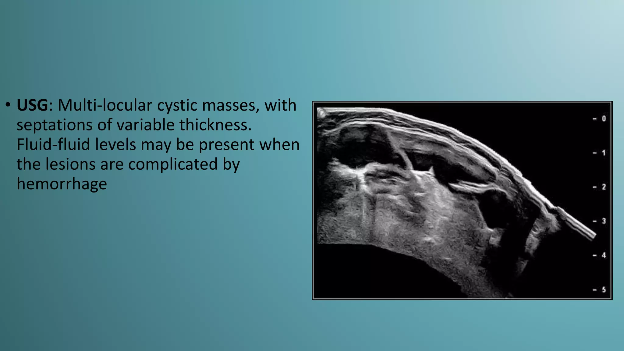 Congenital neck mass radiology pk final | PPTX