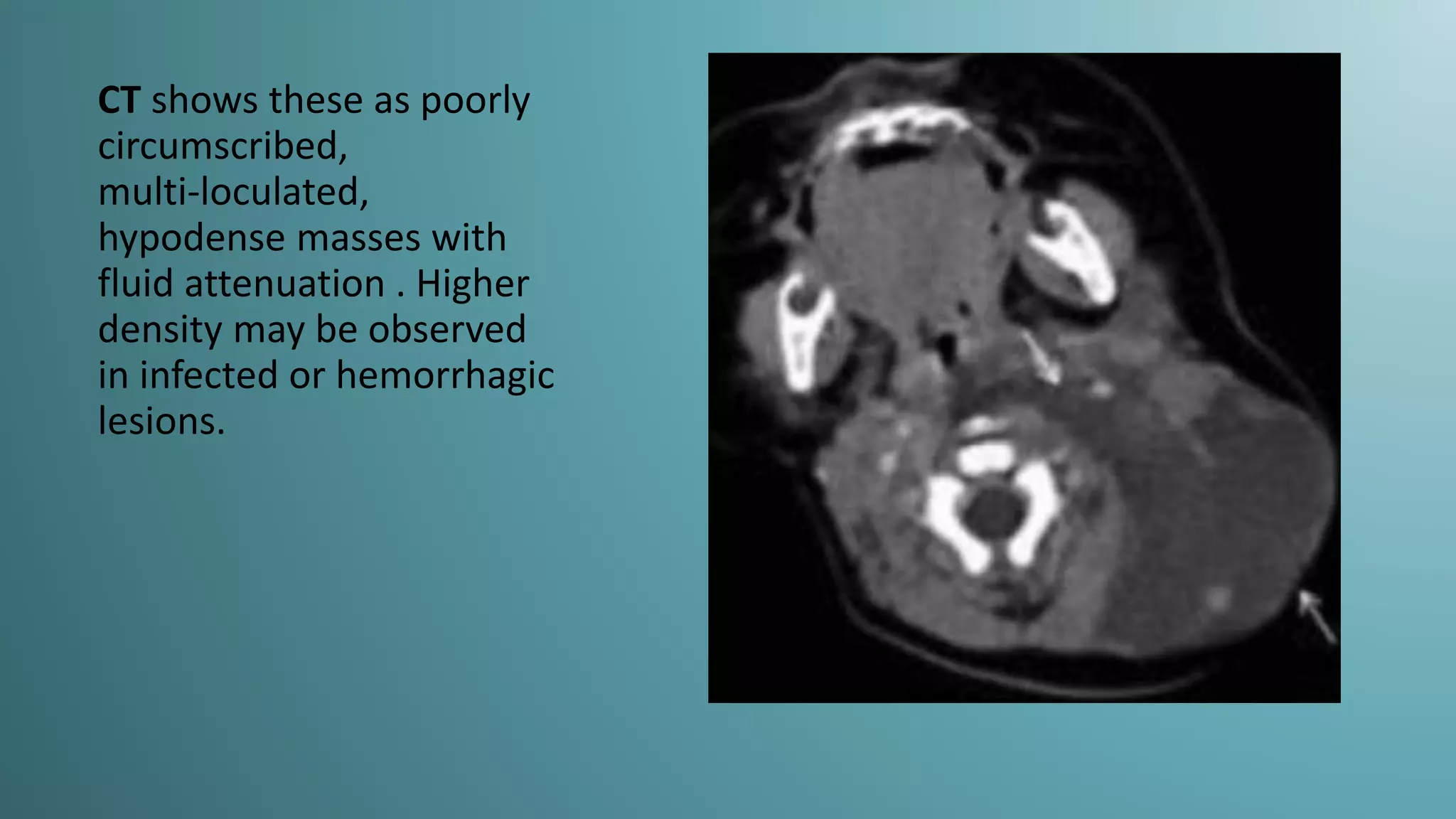Congenital neck mass radiology pk final | PPTX