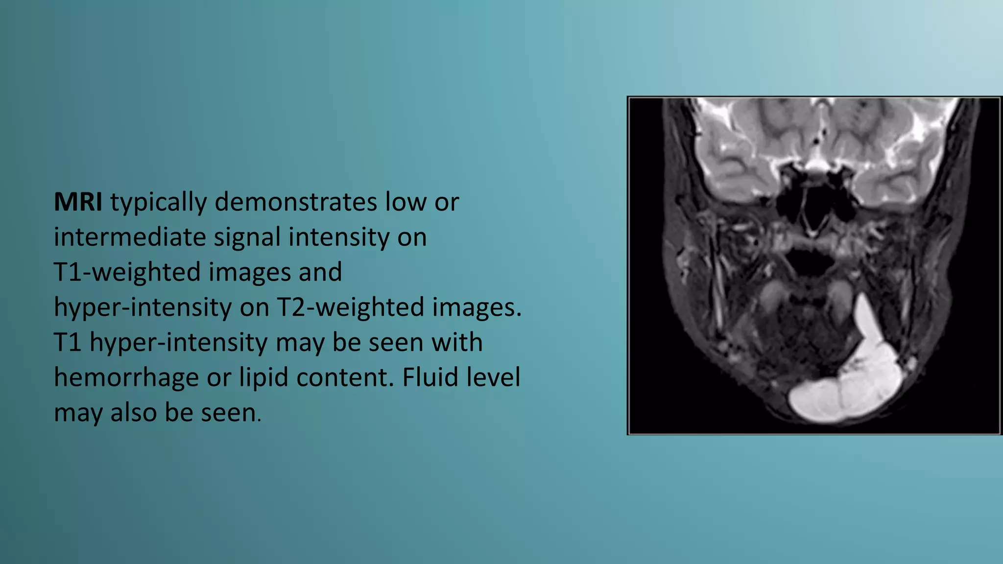 Congenital neck mass radiology pk final | PPTX