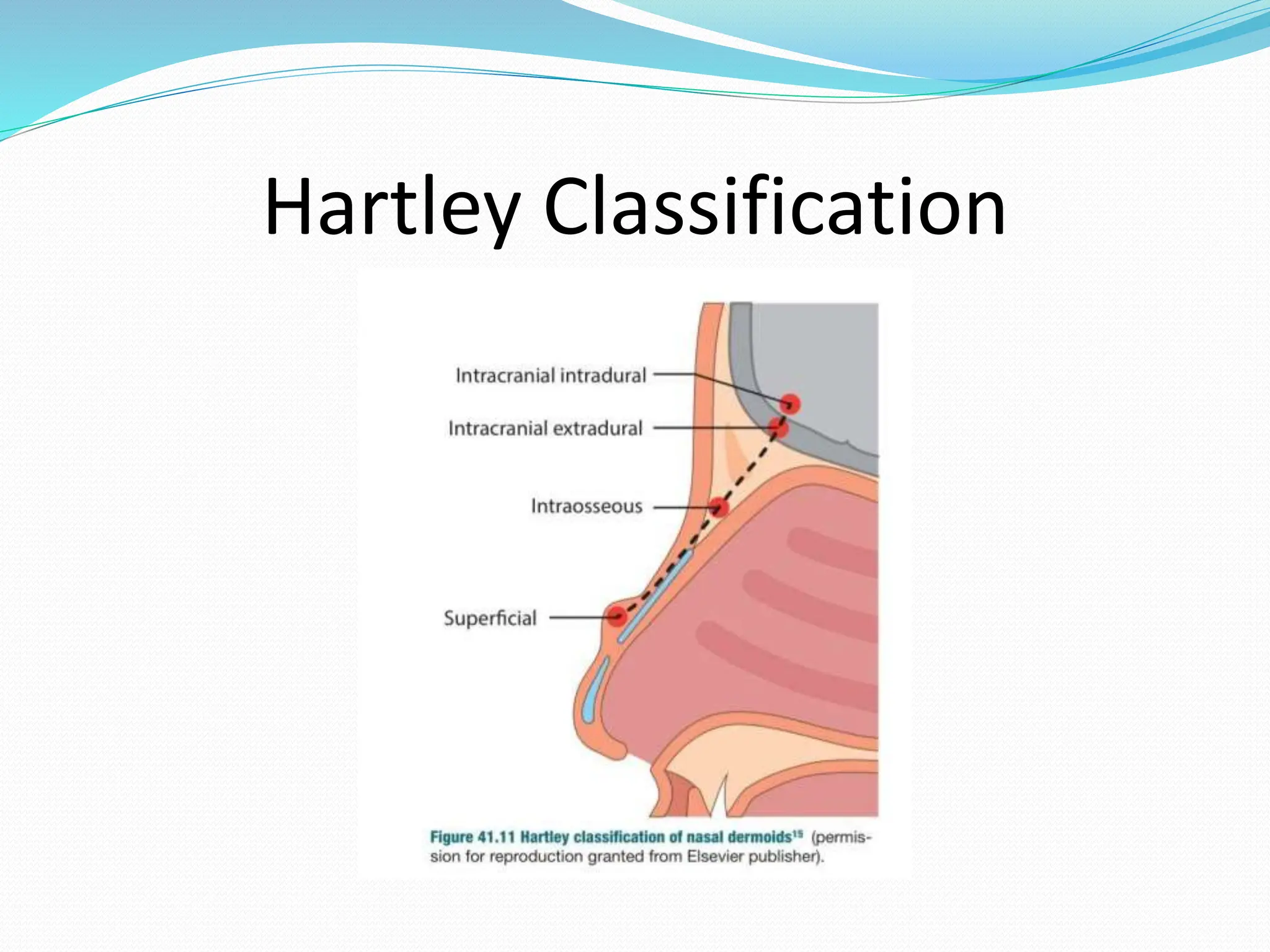 Congenital Sinuses of The Neck and its Etiology | PPTX