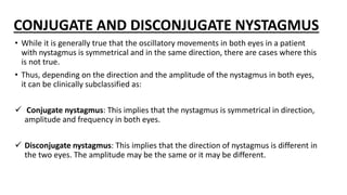 Congenital nystagmus | PPT