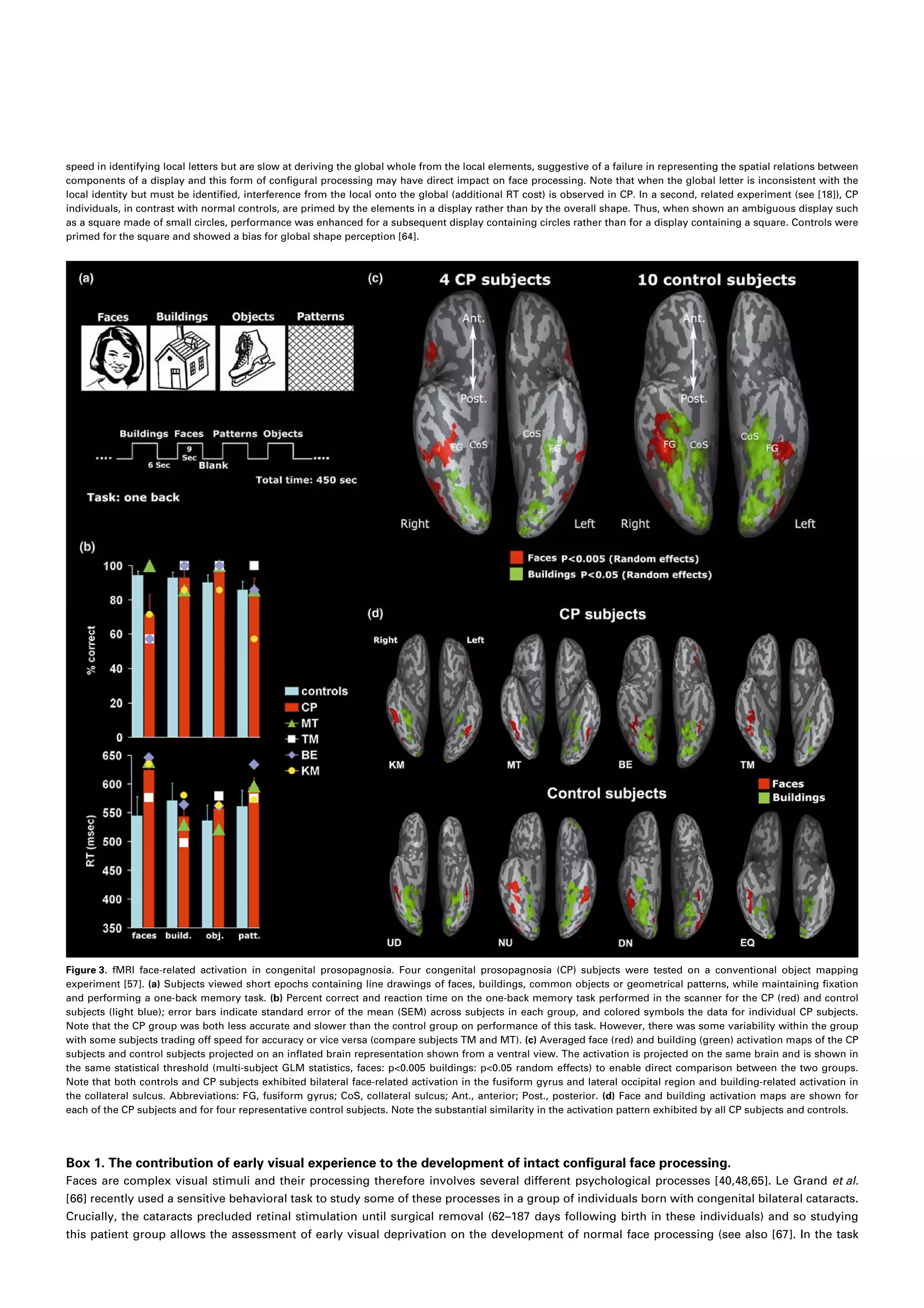 Congenital Prosopagnosia_ Face-Blind from Birth.pdf
