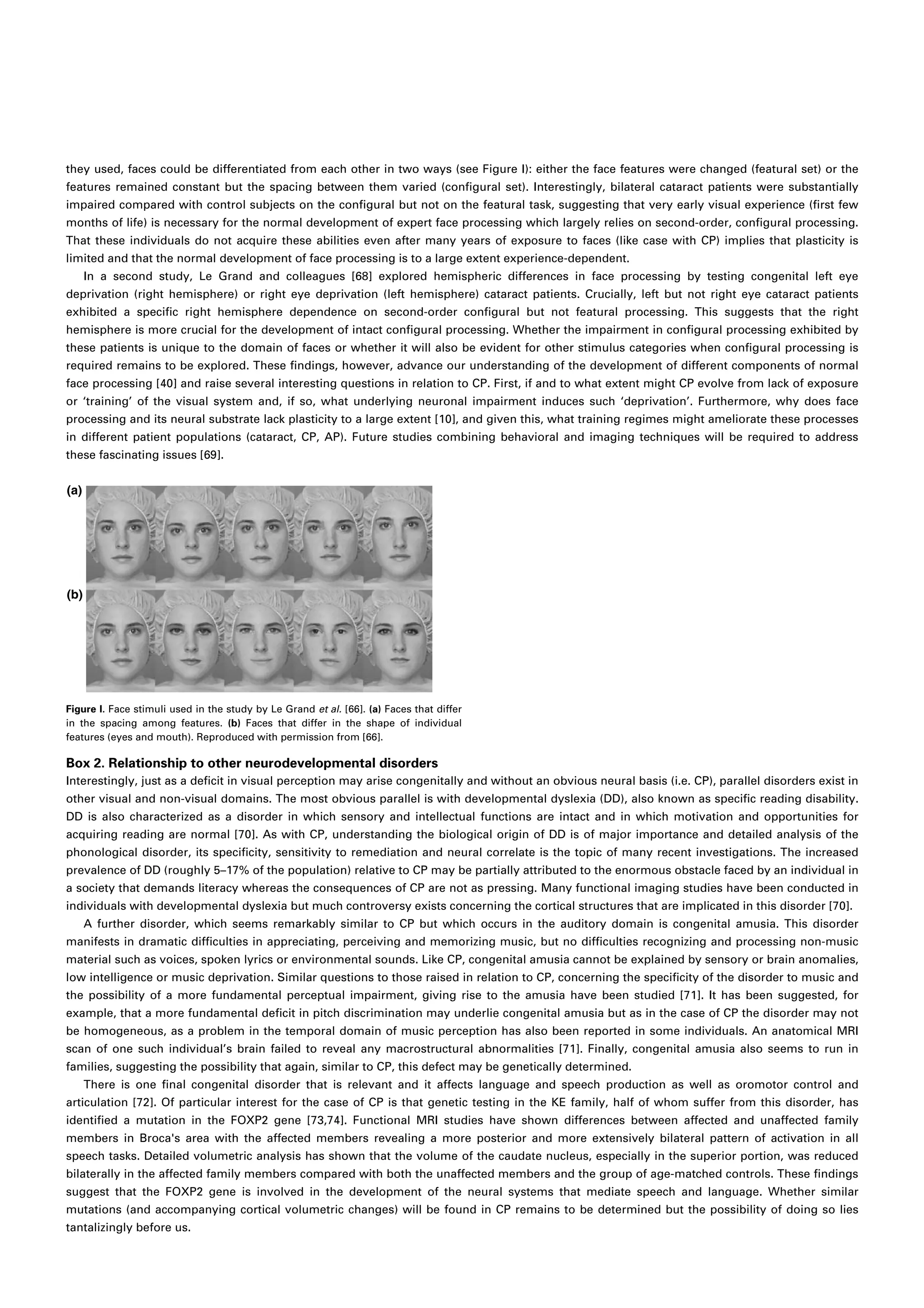 Congenital Prosopagnosia_ Face-Blind from Birth.pdf