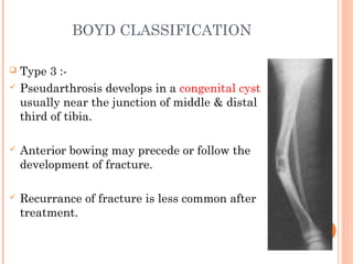 Congenital pseudarthrosis of tibia | PPT